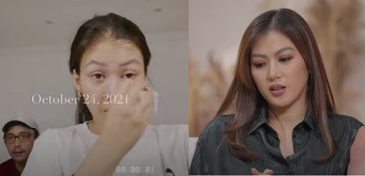 Alex Gonzaga's Unbreakable Spirit Prevails Amid Second Miscarriage | NewsFeed