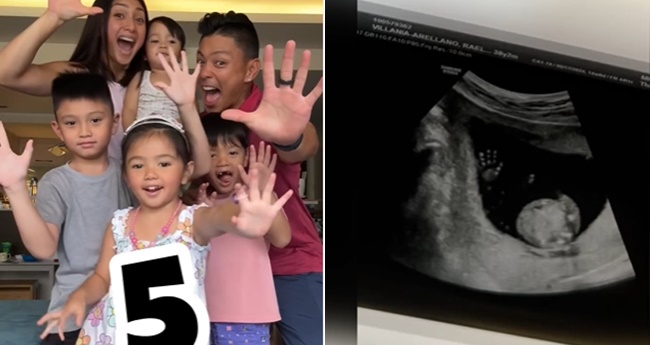 Iya Villania and Drew Arellano Announce Baby No. 5 | NewsFeed