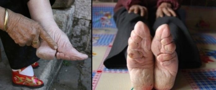 Do You Know The Reason Why Women In China Bound Their Feet?