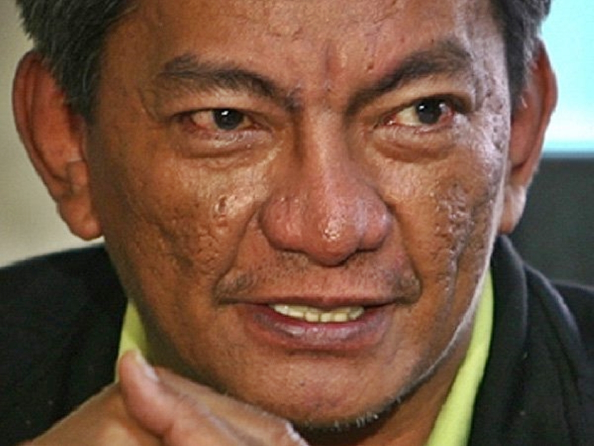 Salceda Wants End Of Marcos Sr.'s Issue As It Divided Ph For 30 Years