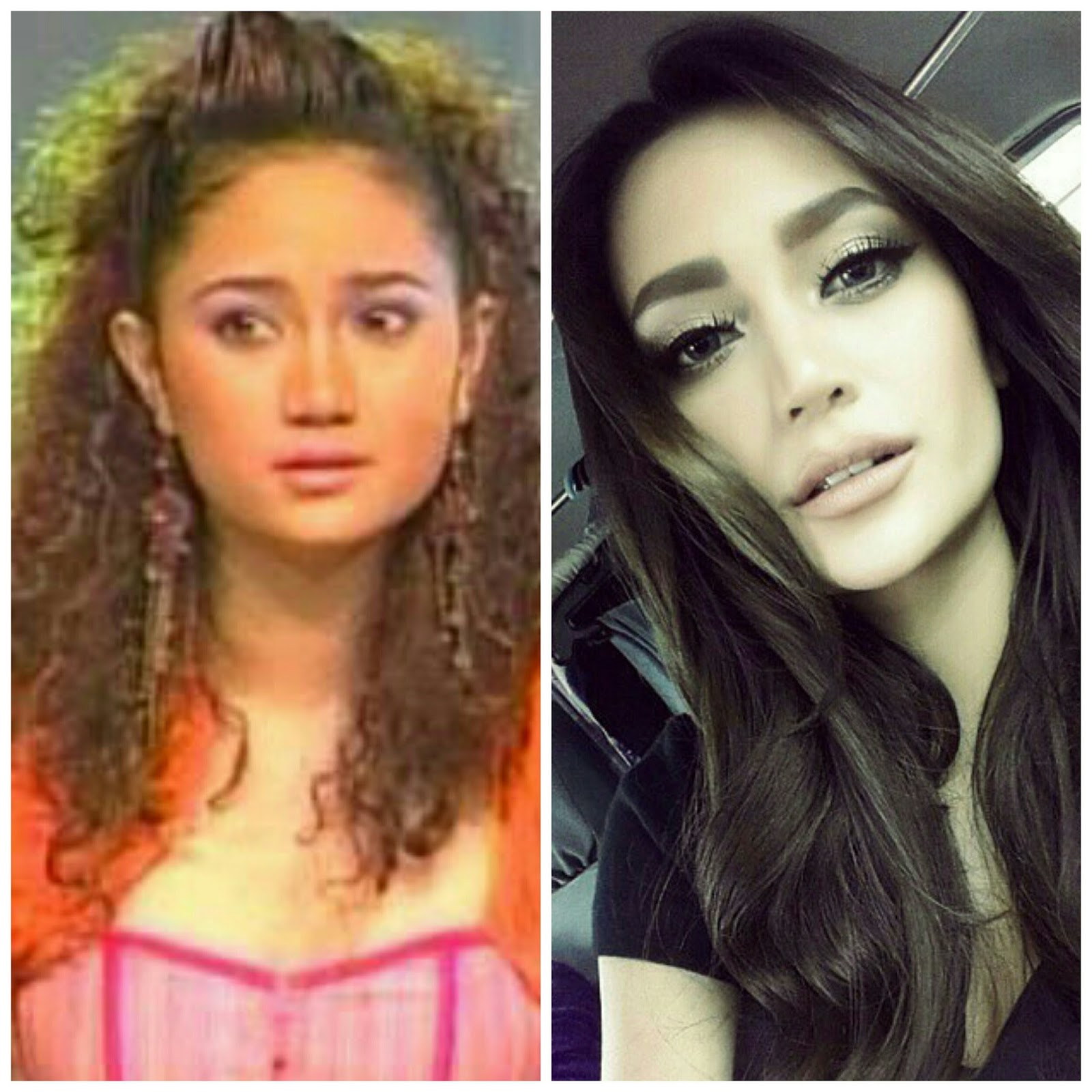 Top 10 Shocking Retokada Pinoy Celebrities: Shocking