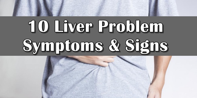 LIVER PROBLEM SYMPTOMS - List Of 10 Signs Of Liver Problem