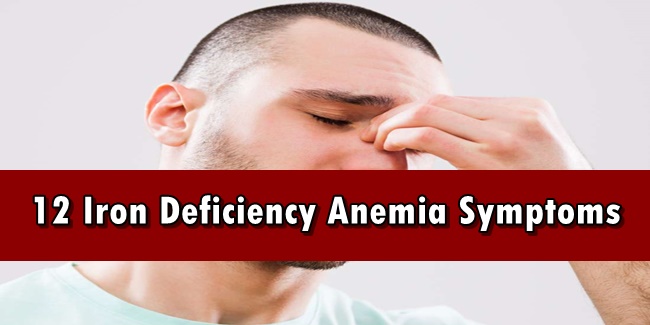Iron Deficiency Anemia Symptoms Signs | NewsFeed