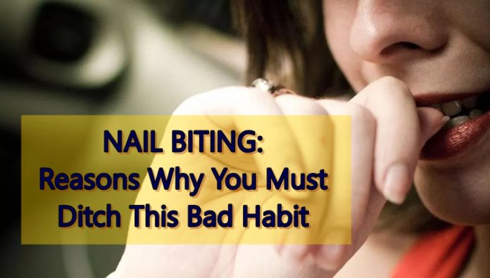NAIL BITING: Reasons Why You Must Ditch This Bad Habit