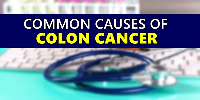 COLON CANCER CAUSES - List Of Common Causes Of This Disease