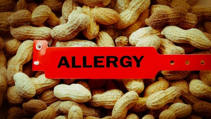 PEANUT ALLERGY: Symptoms, Causes & Risk Factors