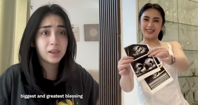 Meray Yamada Confirms He Is the Father of Bea Borres’ Baby | NewsFeed